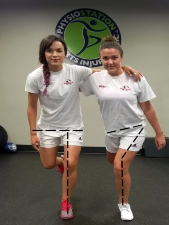 ACL Injuries in Women: 7 Key Causes, Symptoms & Treatment Options